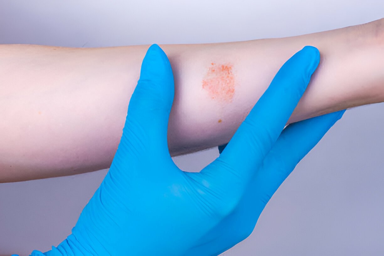Medical Conditions | Skin Genesis Clinic